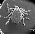 Watch A Tick Survive Under An Electron Microscope – Photoxels